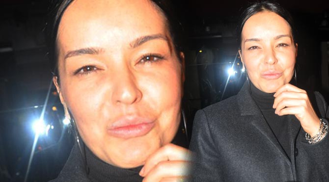 Bengü’nün dudakları - Sözcü