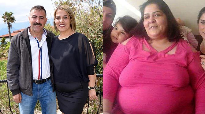1 yılda 84 kilo verip 84 kiloya düştü - Sözcü