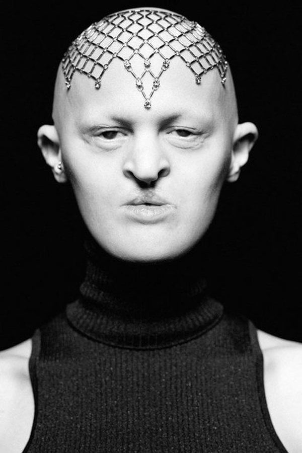 Hastalıkları onları yıldırmadı - Sözcü