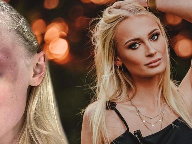 Belçikalı model Anthonia Rochus şiddeti fotoğraflarla belgeledi - Sözcü